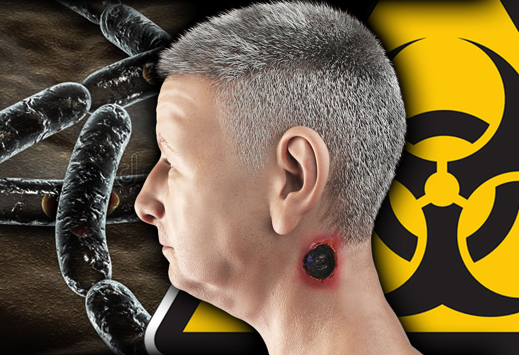 Antraks – Biološko oružje svjetskih sila – Slučajno? – Vijesti – Logično